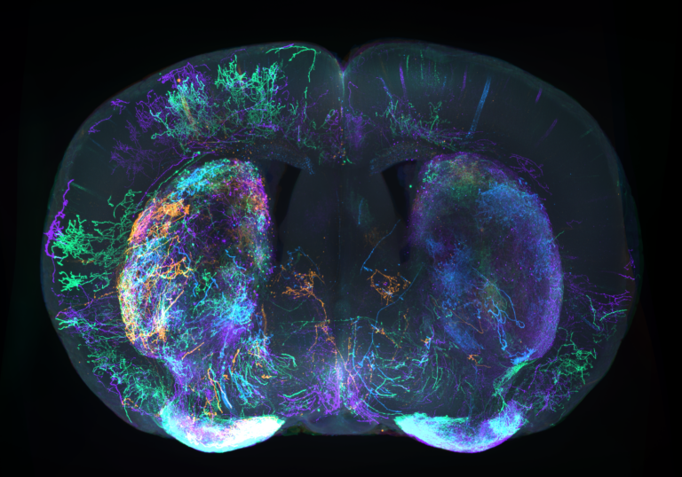Cadence Neuroscience Raises $26M to Develop Neural Implants | Life ...