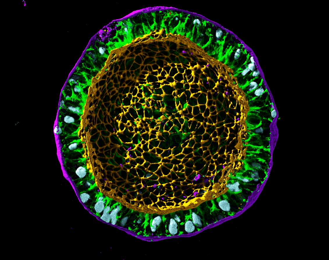 Seattle’s Allen Institute Launches ‘Moonshot’ to Create New Approach to ...